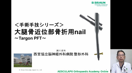 Targon PFT Sharing expertise～ 私の実践するshort femoral nail ～ – AESCULAP ...